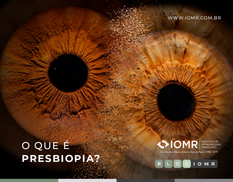 O que é Hiposfagma? – IOMR | Instituto de Oftalmologia Marco Rey
